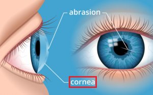 All About Eyes And Eye Care - LF Hospital and Research Centre